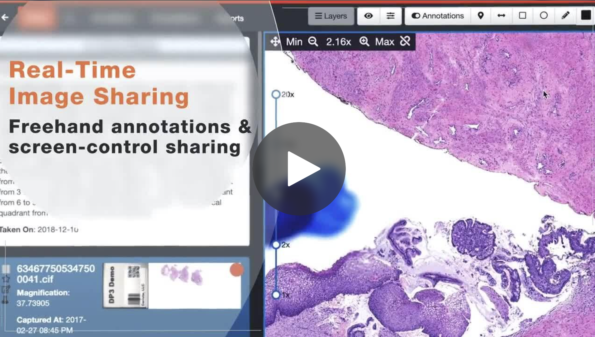 Unlock the Power of DP3